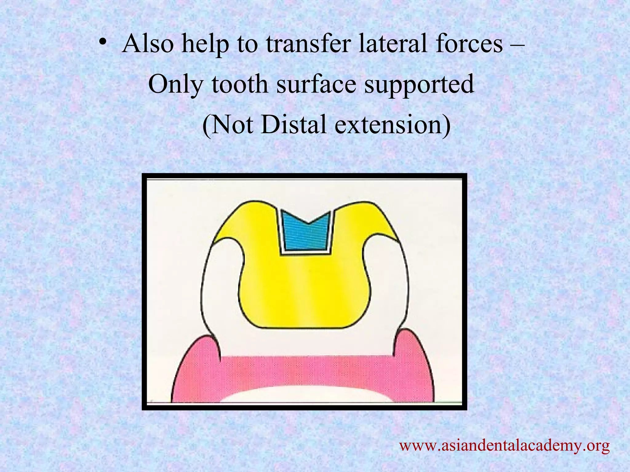 Rests & Rest seats in removable partial Dentures | PPT