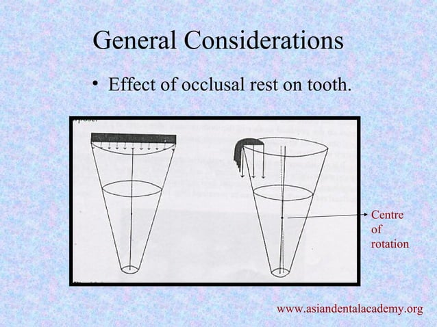 Rests & Rest seats in removable partial Dentures | PPT