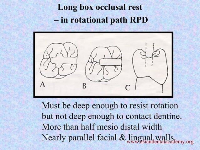 Rests & Rest seats in removable partial Dentures | PPT
