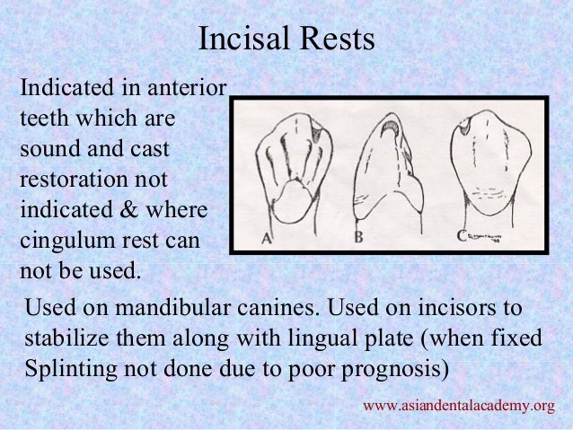Rests & Rest seats in removable partial Dentures