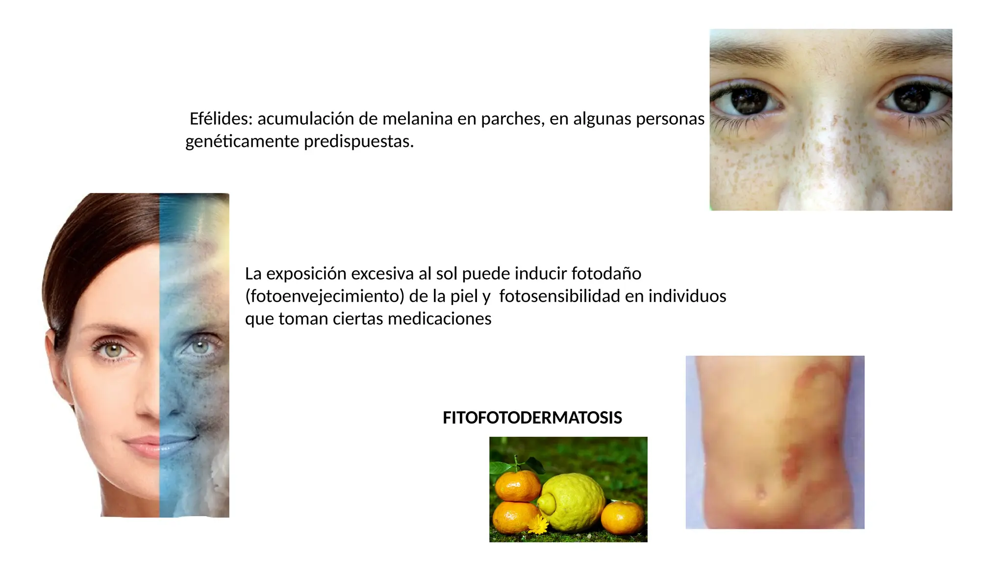 04 SISTEMA TEGUMENTARIO ANATOMOFISIOLOGÍA-2.pptx