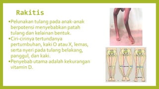 04 sistem gerak pada manusia gangguan | PPT