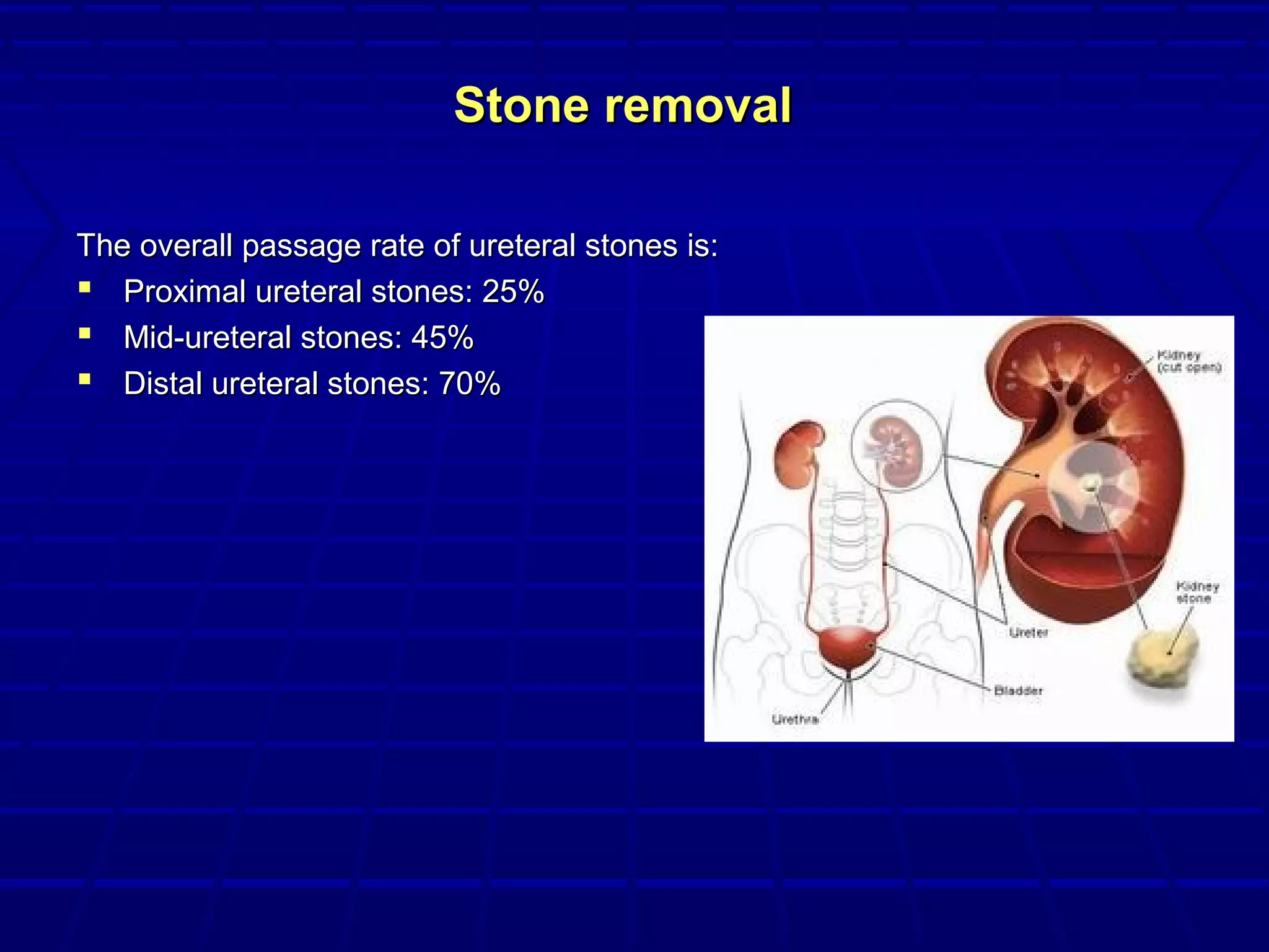 Urinary Stones Disease - Urolithiasis | PPT