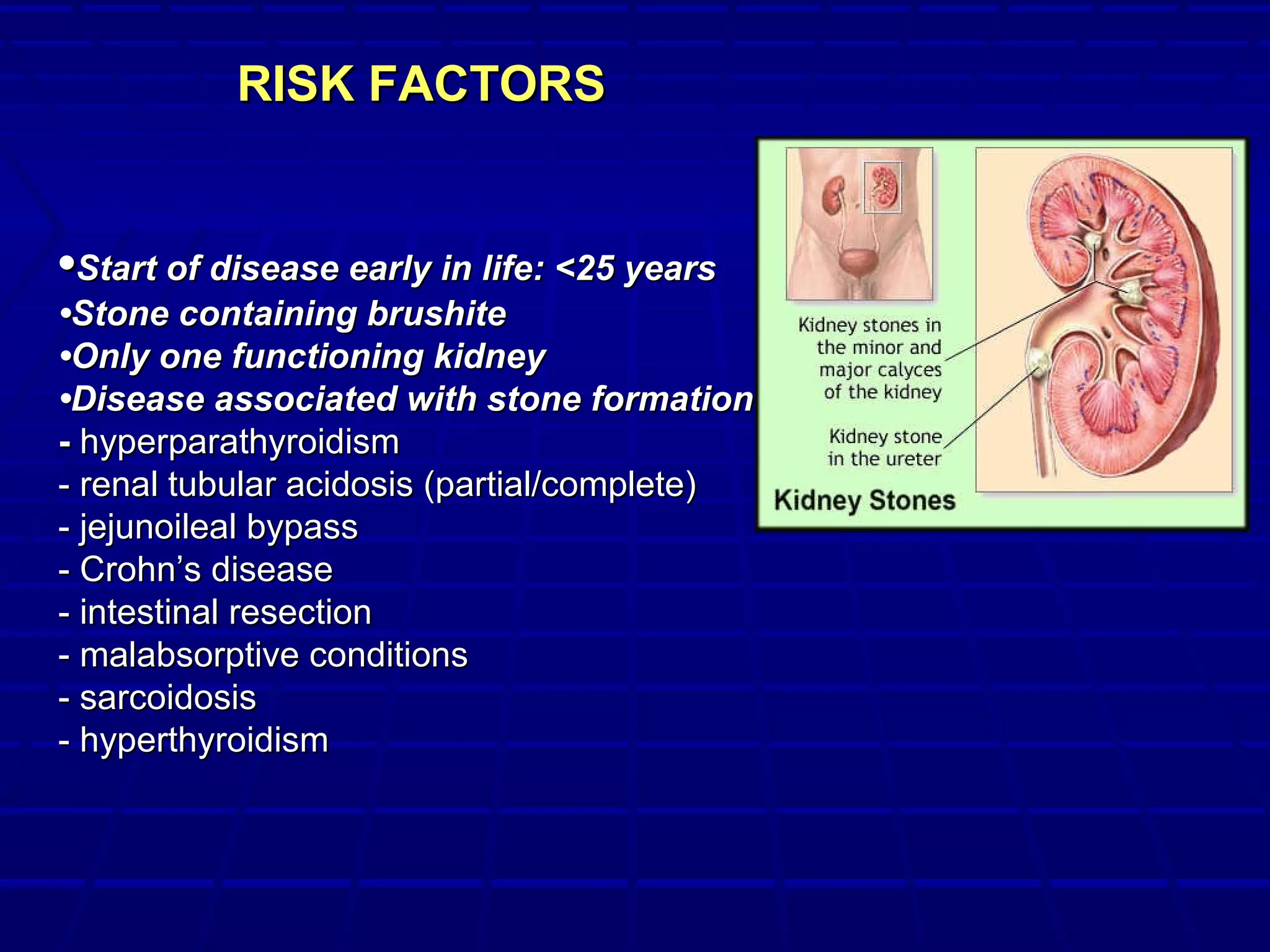 Urinary Stones Disease - Urolithiasis | PPT
