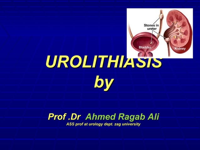 Urinary Stones Disease - Urolithiasis | PPT