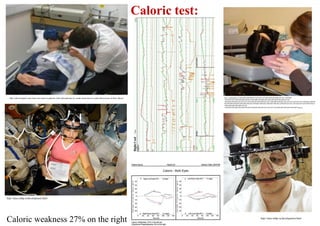 04 Vestibulary system English 081020.pdf