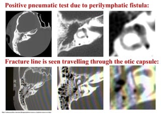 04 Vestibulary system English 081020.pdf