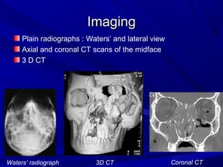 Methods of conservative and operational treatment of the facial skull ...