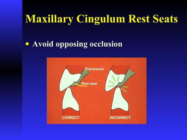 05. rests & rest seats | PPT | Dental Health | Diseases and Conditions