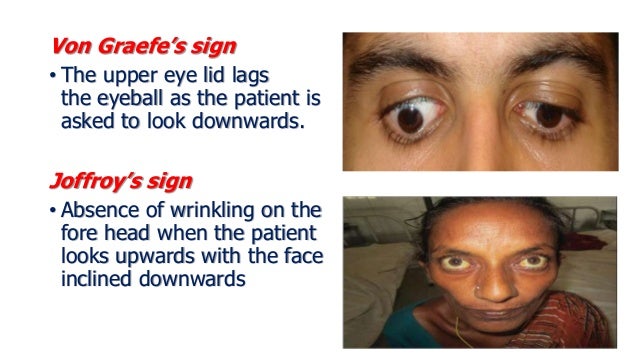 05. evaluation of thyroid gland