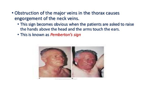05. evaluation of thyroid gland