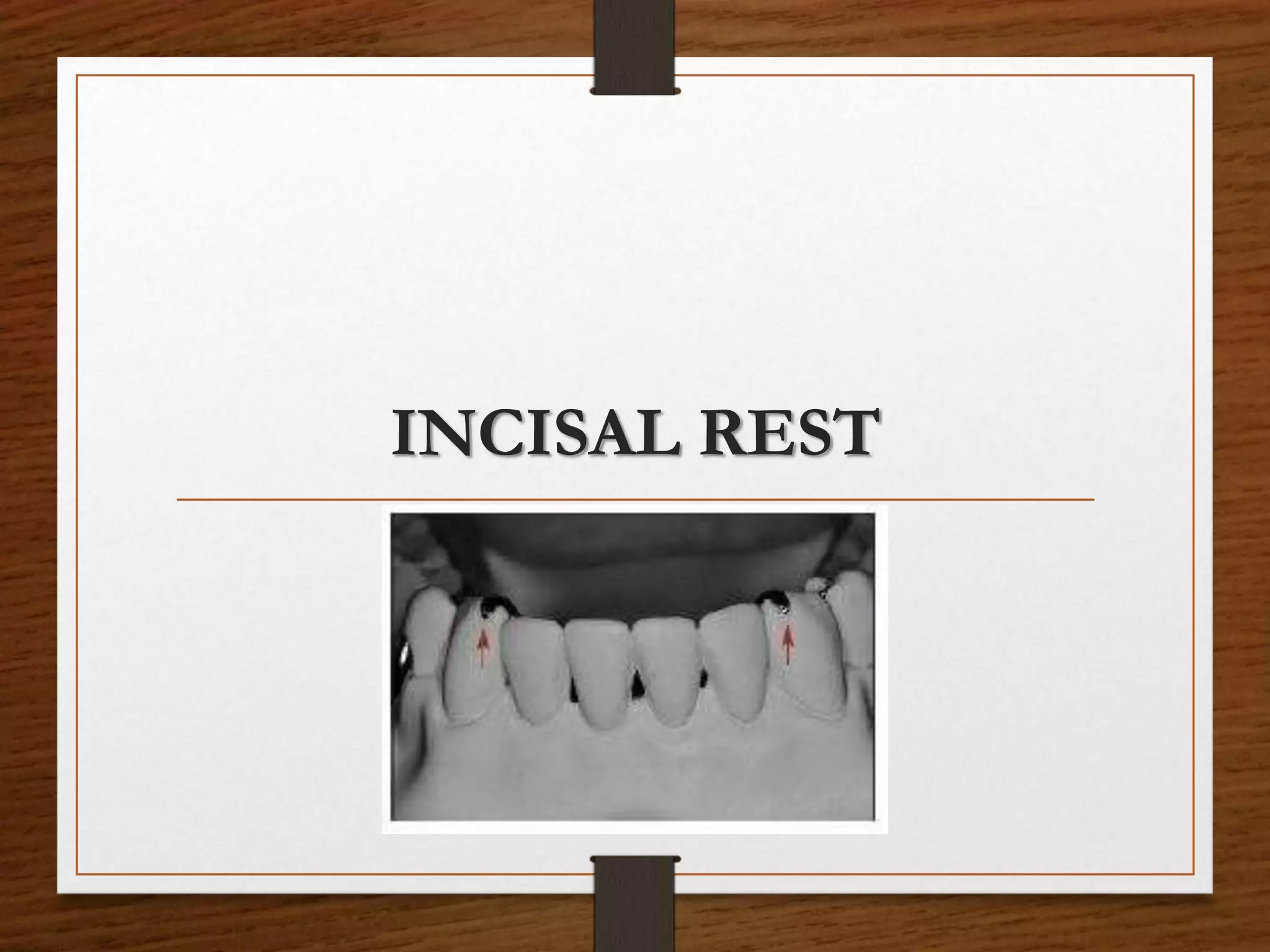 05. rest seats and types of rests | PPTX