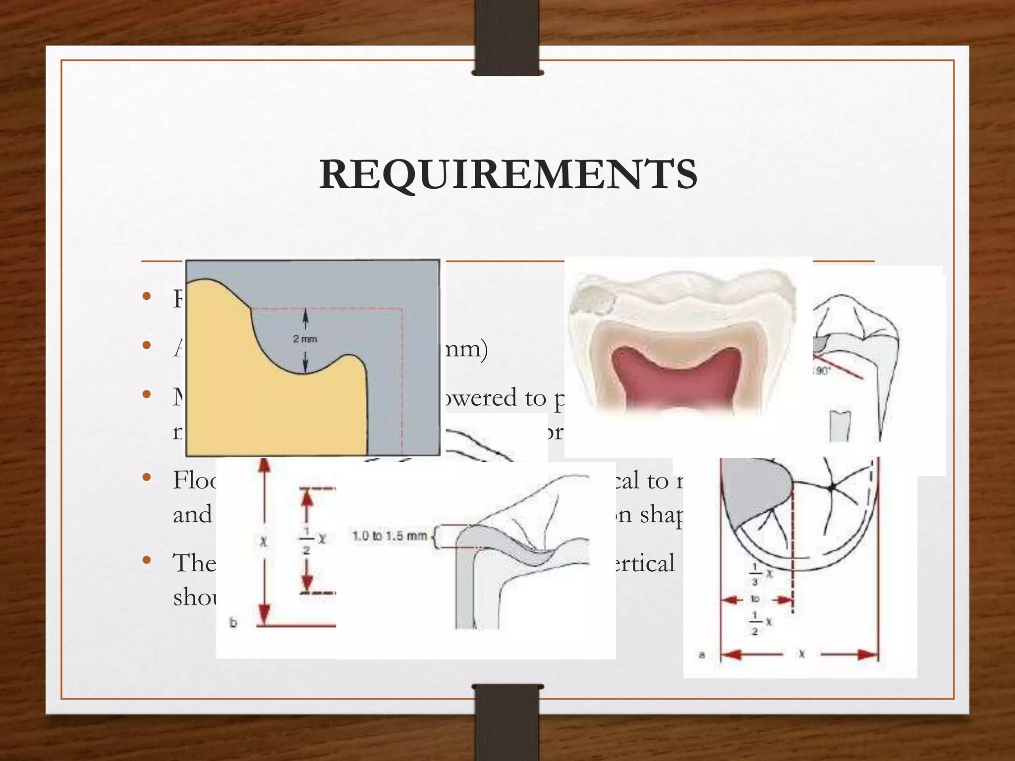 05. rest seats and types of rests | PPTX | Dental Health | Diseases and ...