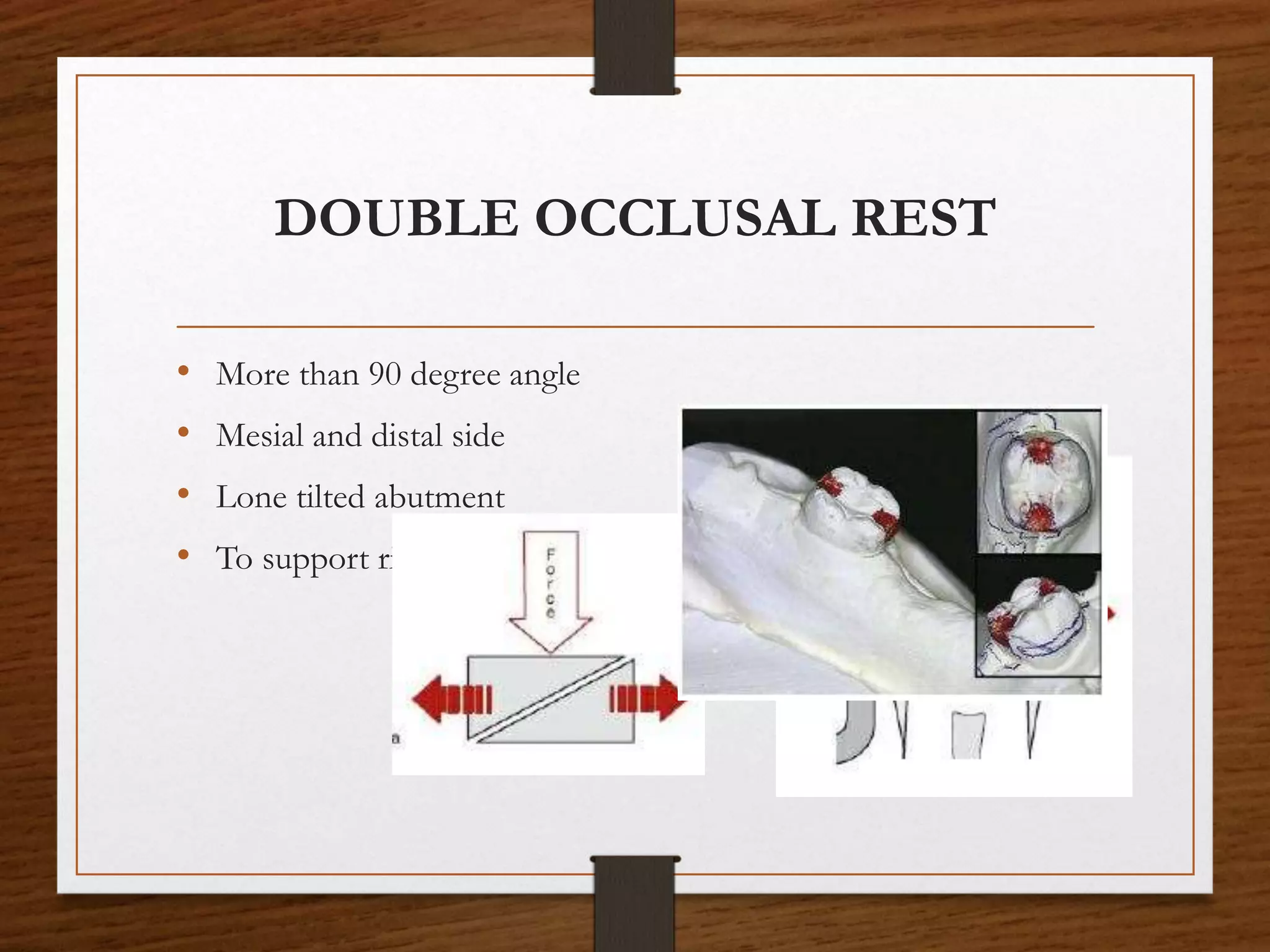 05. rest seats and types of rests | PPTX