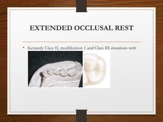 05. rest seats and types of rests | PPTX