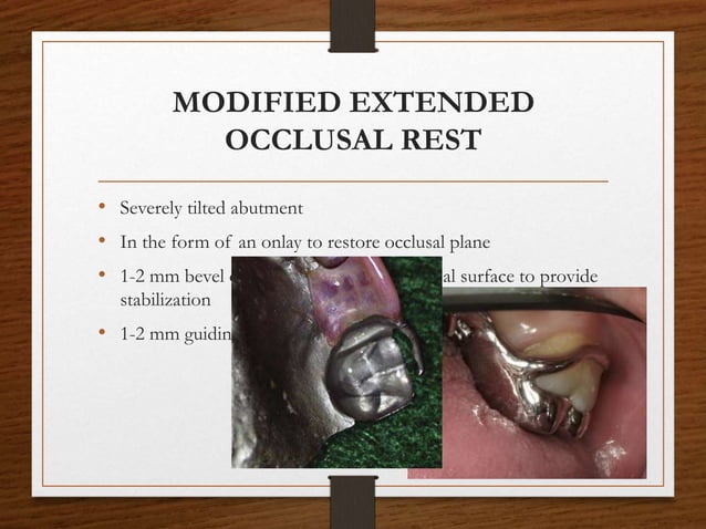 05. rest seats and types of rests | PPTX | Dental Health | Diseases and ...