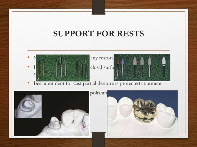 05. rest seats and types of rests | PPTX | Dental Health | Diseases and ...