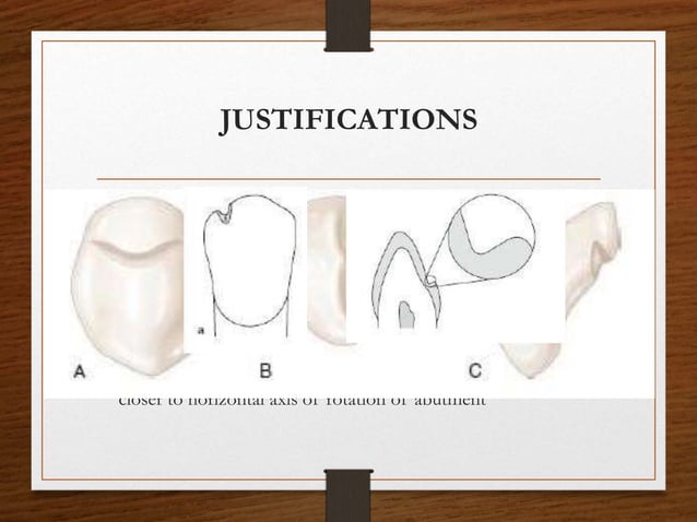 05. rest seats and types of rests | PPTX | Dental Health | Diseases and ...