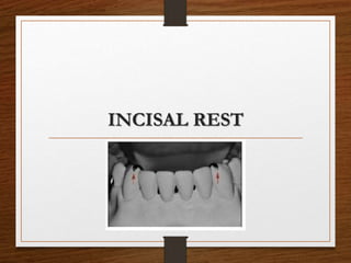 05. rest seats and types of rests | PPTX