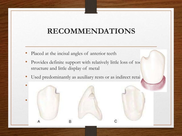 05. rest seats and types of rests | PPTX | Dental Health | Diseases and ...