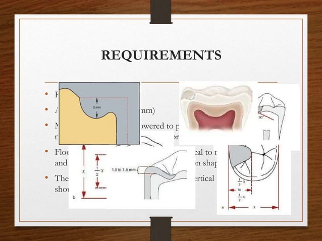 05. rest seats and types of rests | PPTX | Dental Health | Diseases and ...