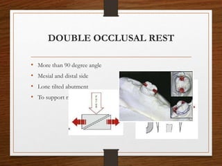 05. rest seats and types of rests | PPTX
