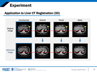 Unsupervised Deformable Image Registration Using Cycle-Consistent CNN | PPT