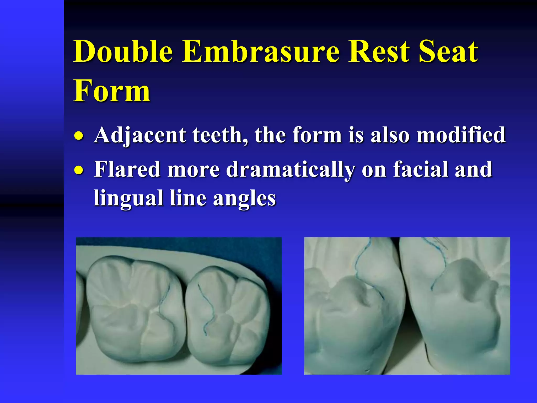 05. Rests & Rest Seats.ppt