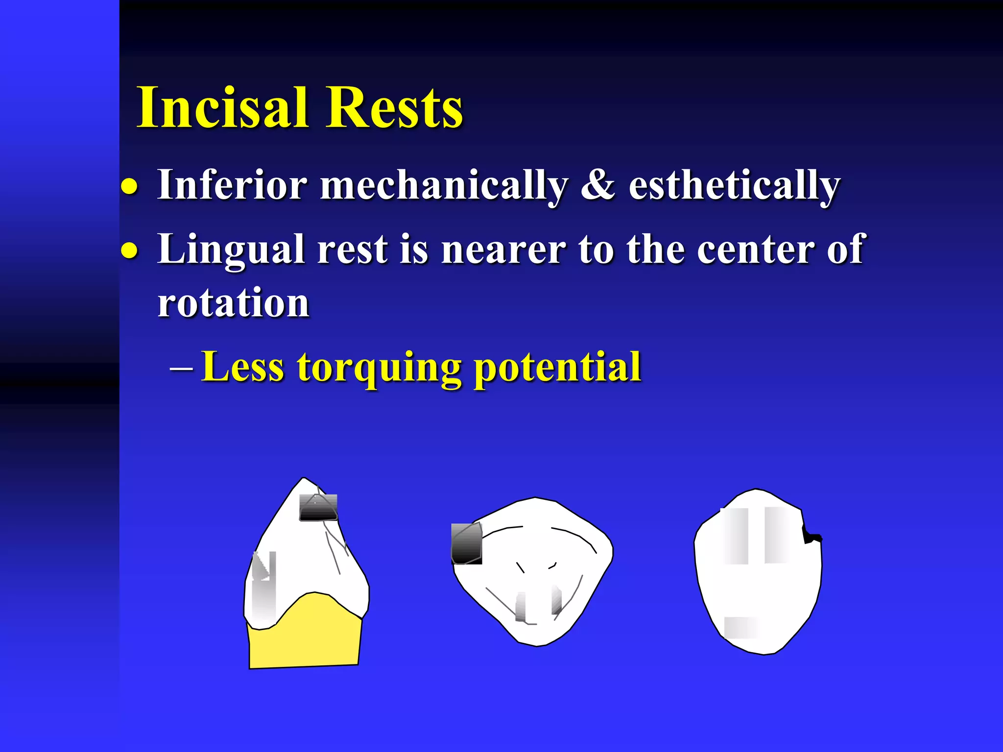 05. Rests & Rest Seats.ppt
