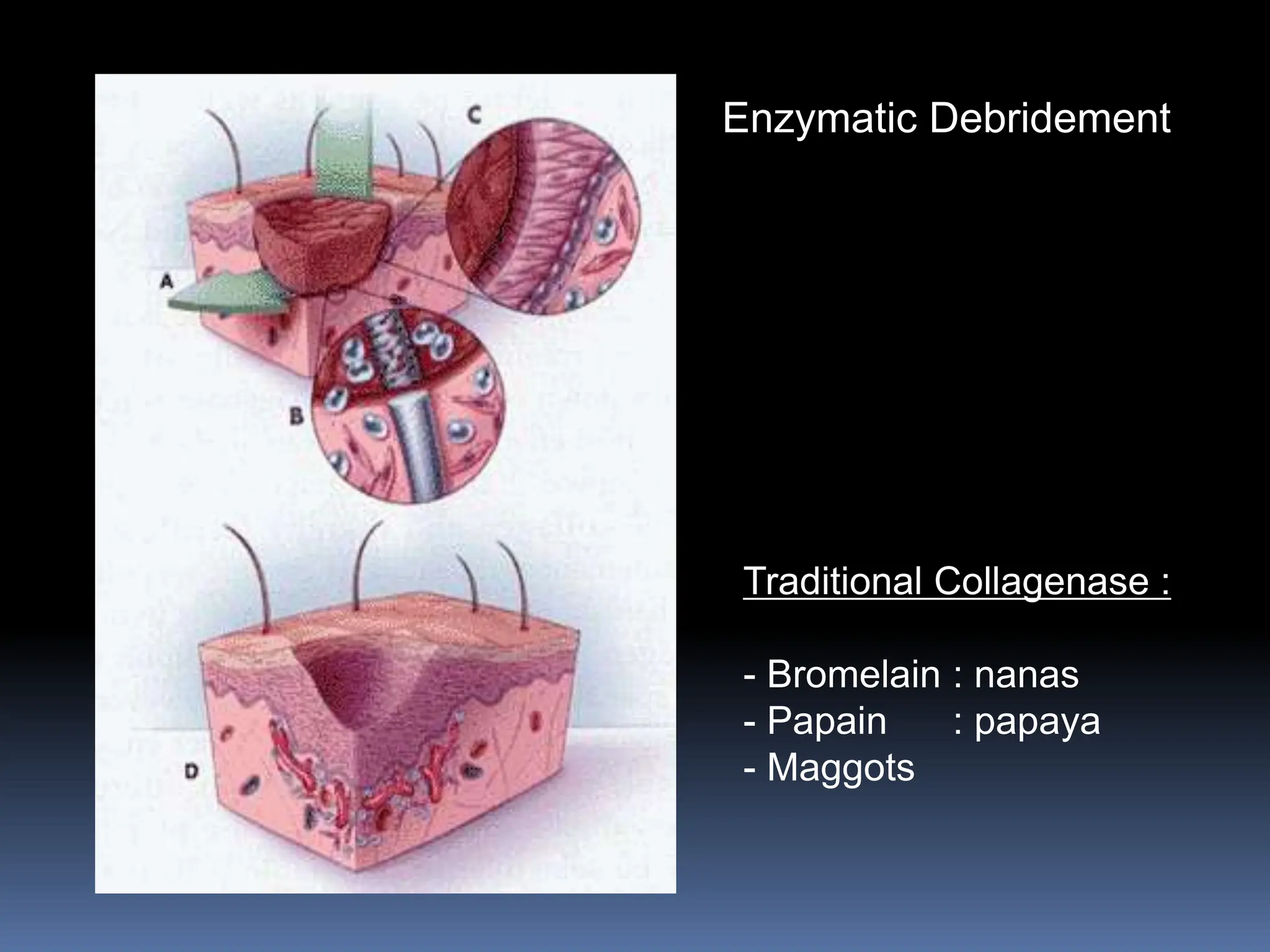 Perawatan luka dan stoma pada pasien post colostomy.ppt