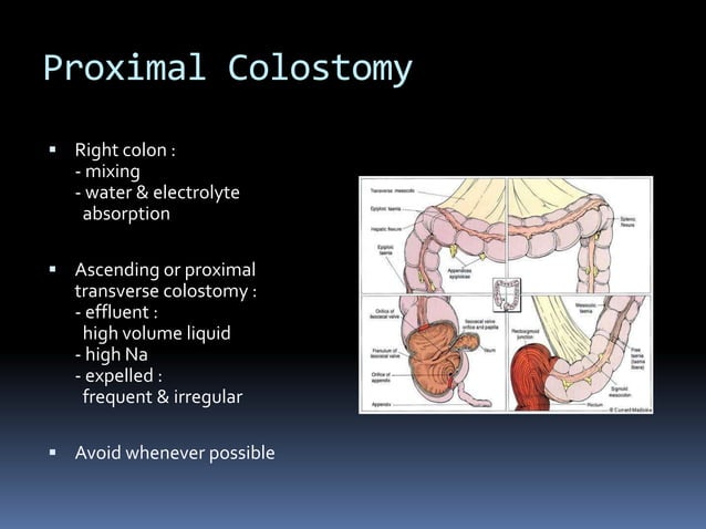 Perawatan luka dan stoma pada pasien post colostomy.ppt | First Aid ...