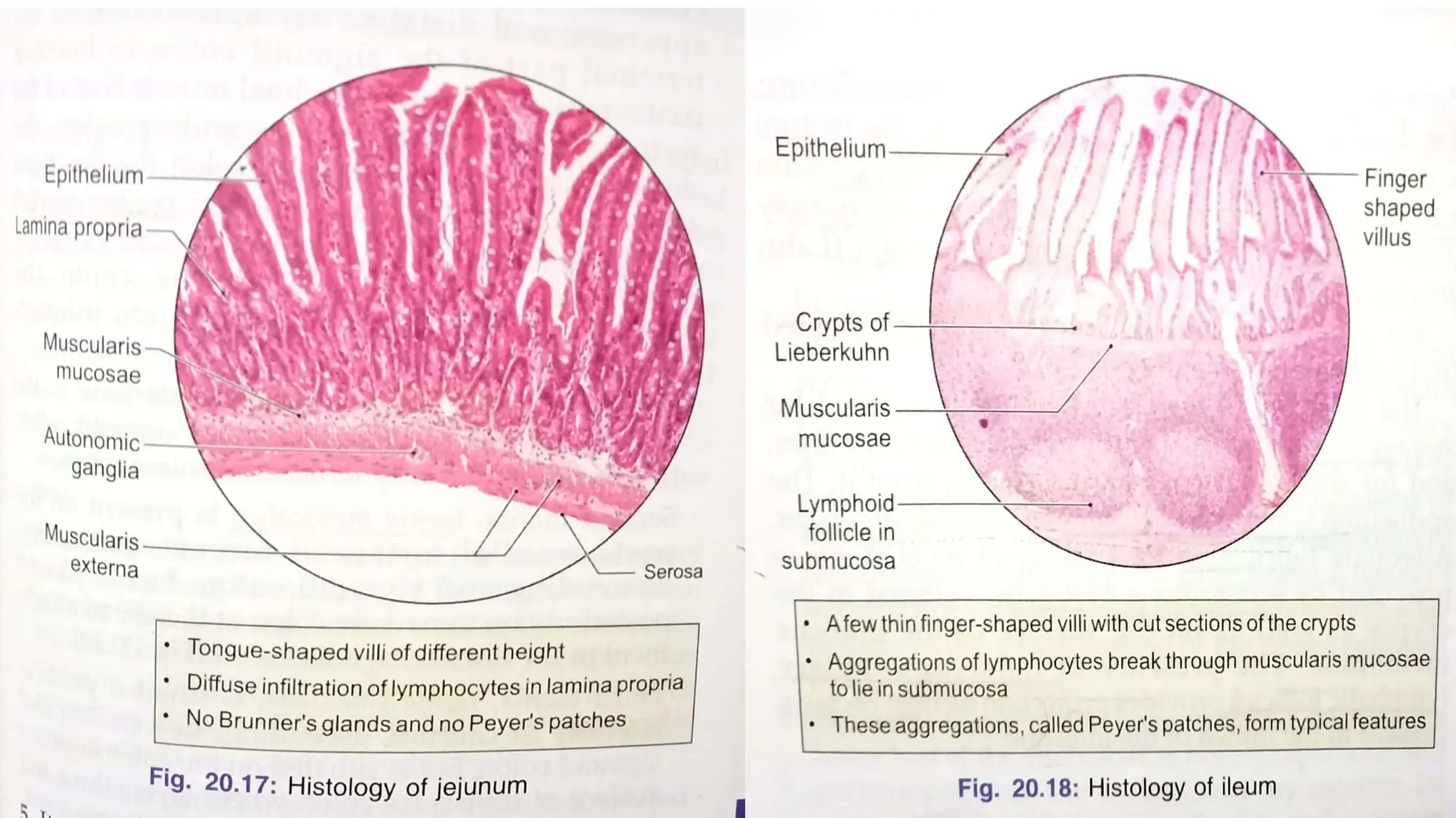 05. jejunum vs ileum.pptxxxxxxxxxxxxxxxx | PPTX