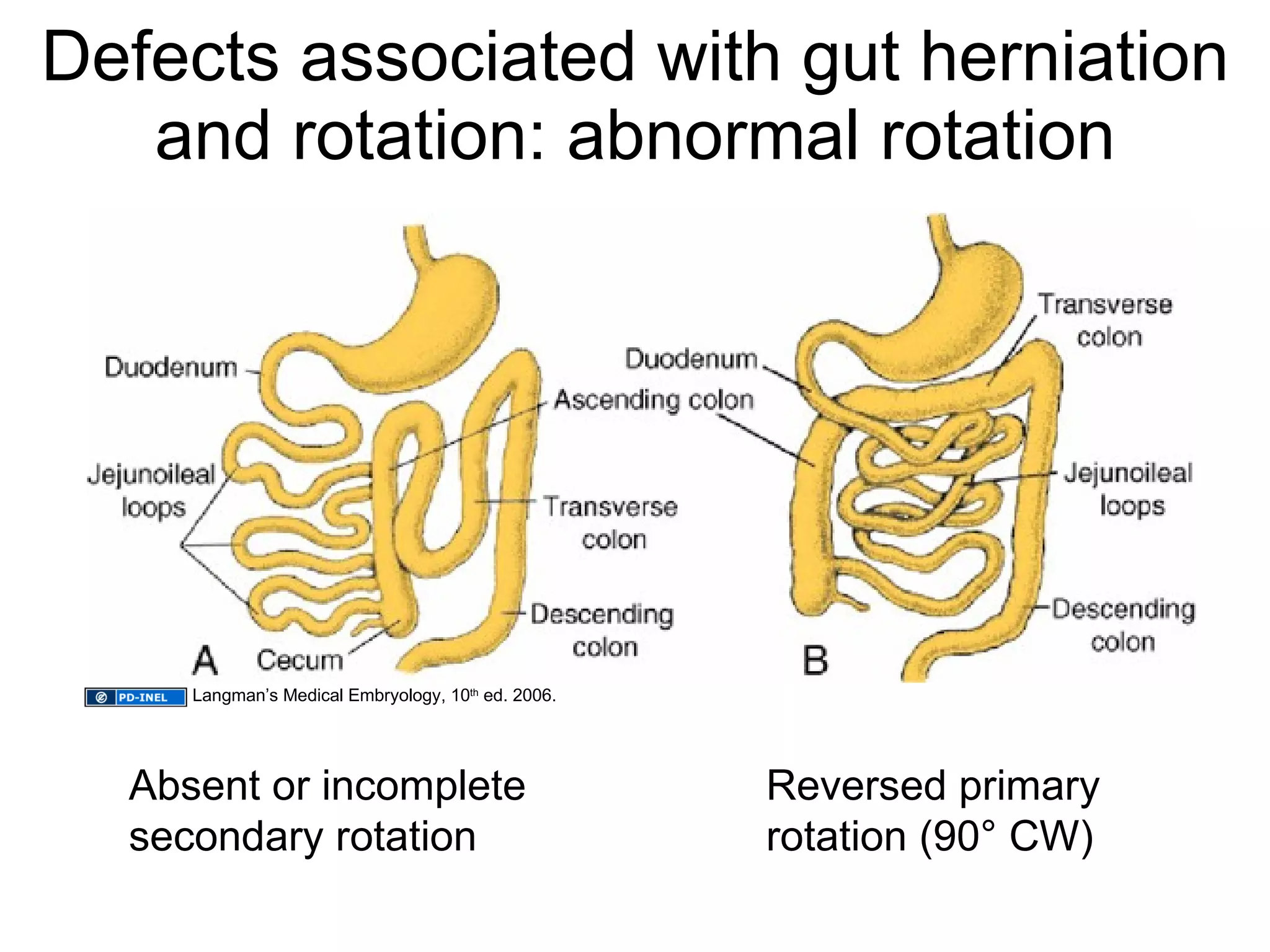 05.28.09(a): Development of the Gastrointestinal System | PPT