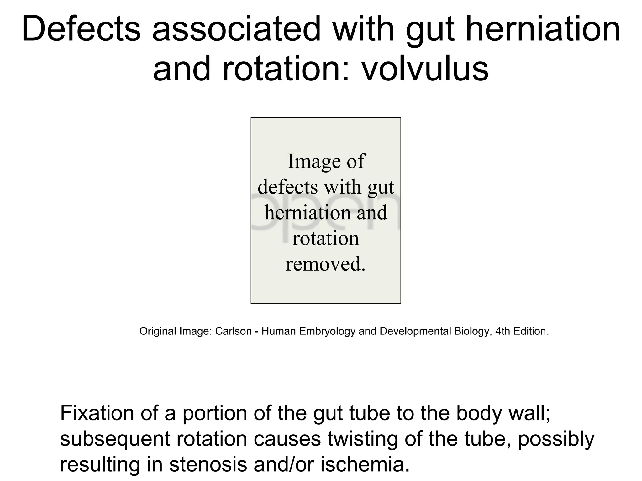 05.28.09(a): Development of the Gastrointestinal System | PPT