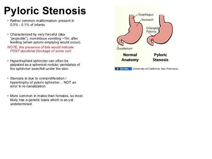 05.28.09(a): Development of the Gastrointestinal System