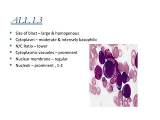 Acute Lymphoblastic Leukemia L1 L2 L3