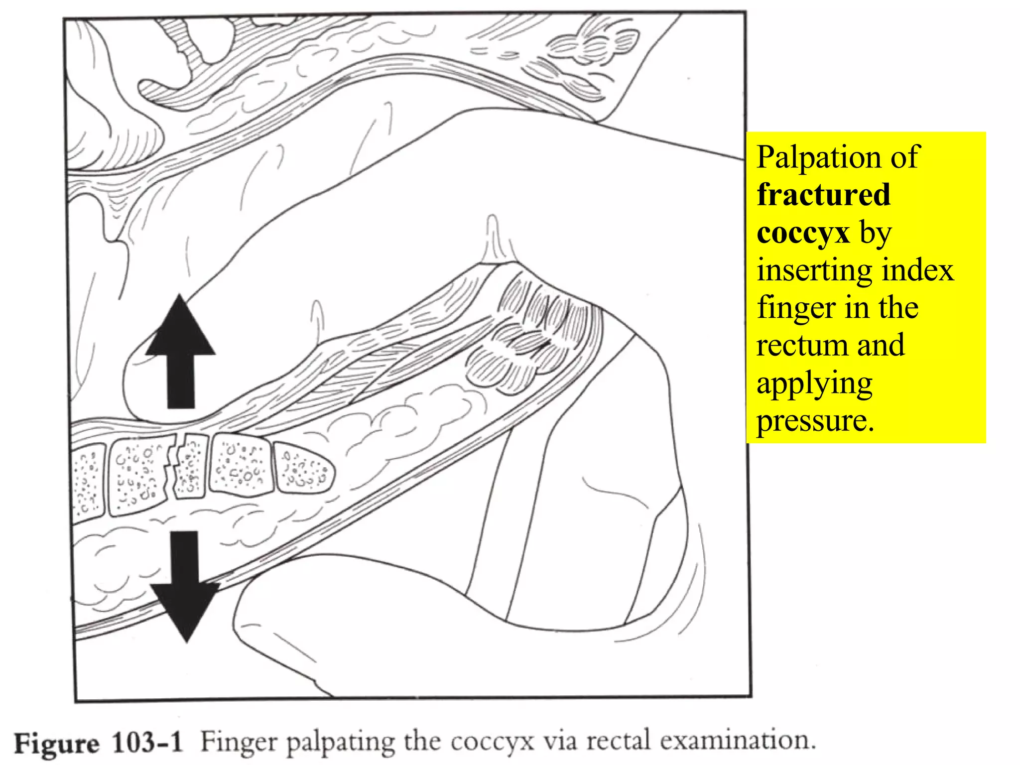 05 Axial Skeleton Vertebral Column And Thoracic Cage | PPT