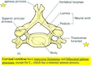 Bifurcated Spinous Process