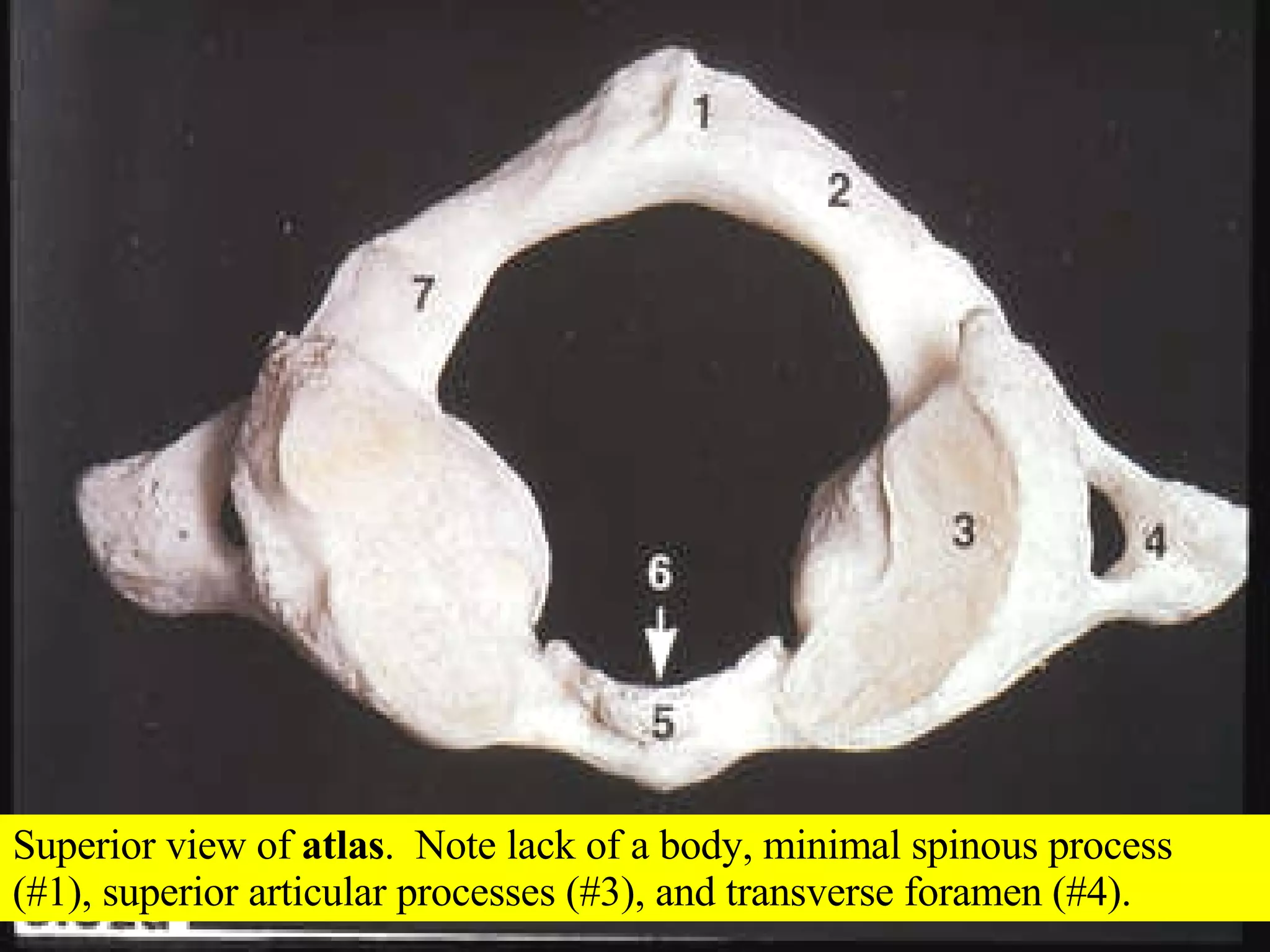 05 Axial Skeleton Vertebral Column And Thoracic Cage | PPT