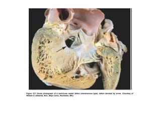 05 Cat. Cardiovascular I | PPT