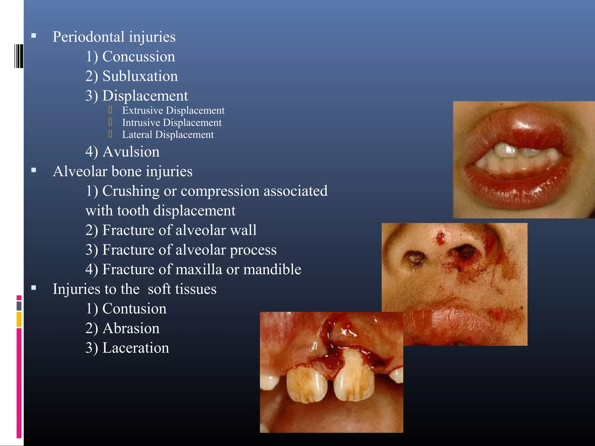 05 dentoalveolar injuries | PPT