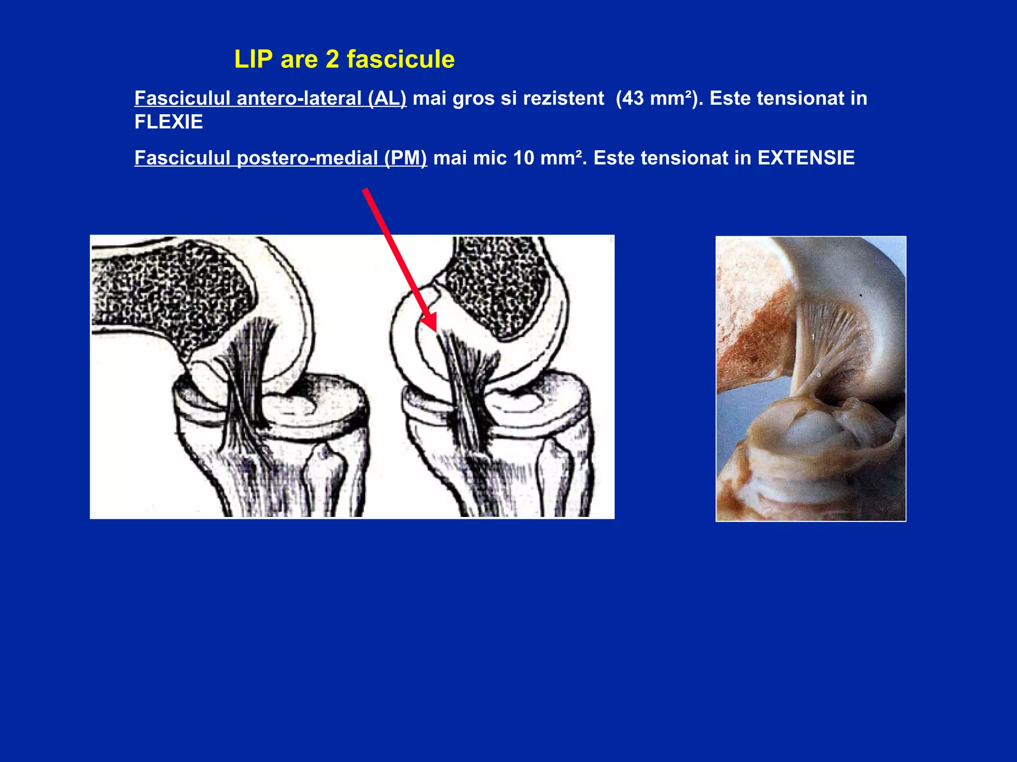 05 ligament incrucisat posterior | PPT