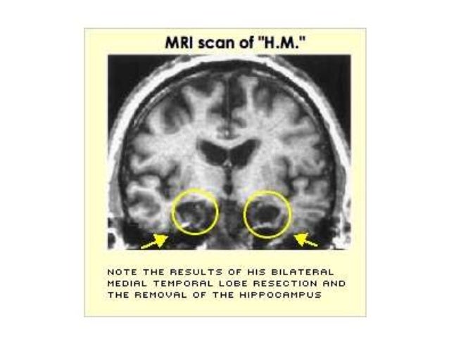 Localization Of Function In The Brain