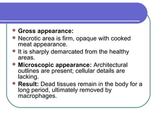 05 necrosis | PPT