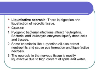 05 necrosis | PPT