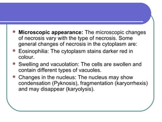 05 necrosis | PPT