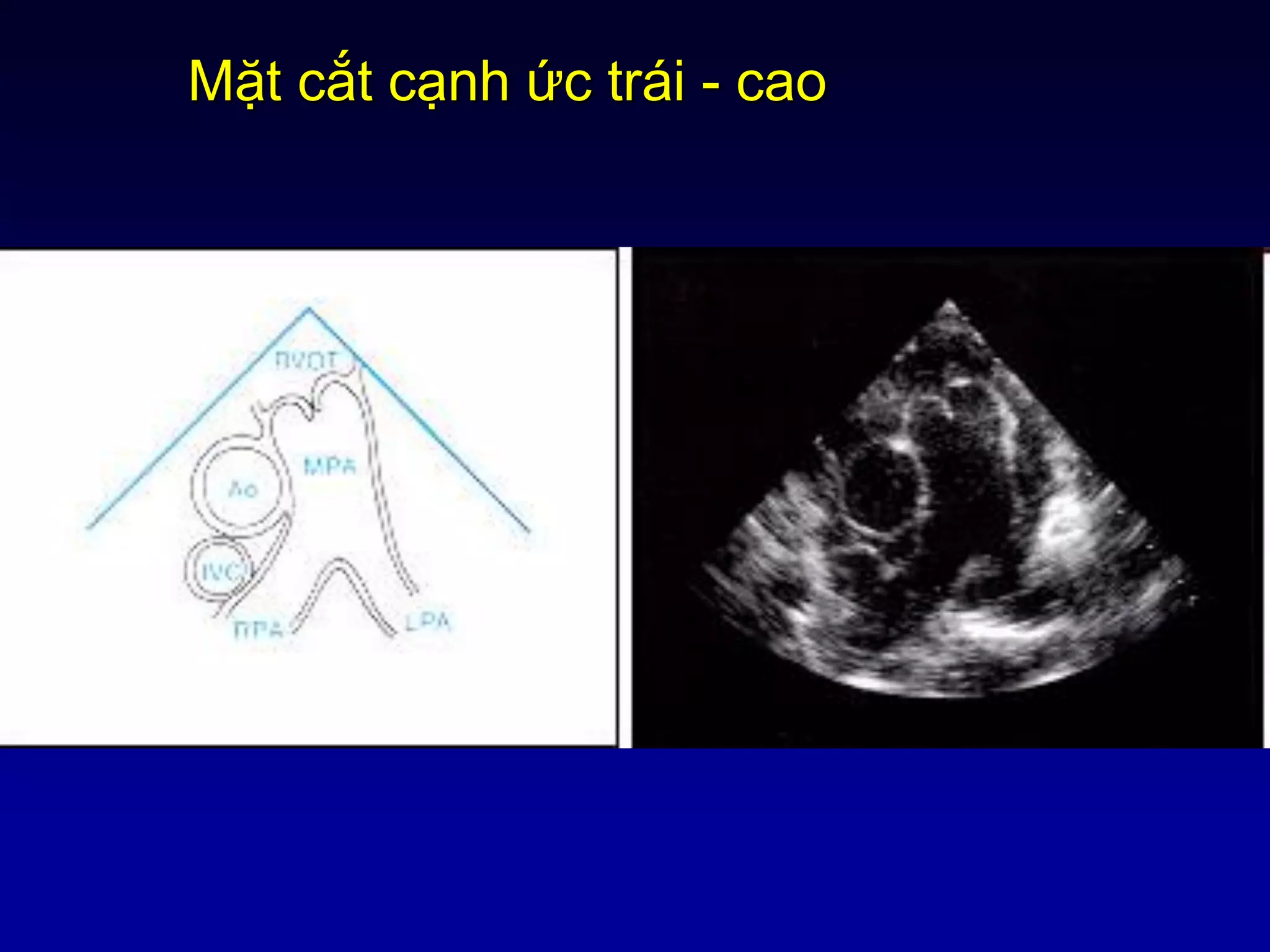 05. sieu am tim co ban | PDF