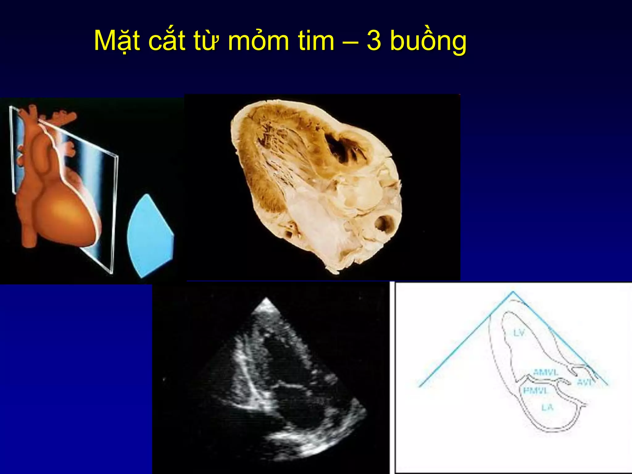 05. sieu am tim co ban | PDF
