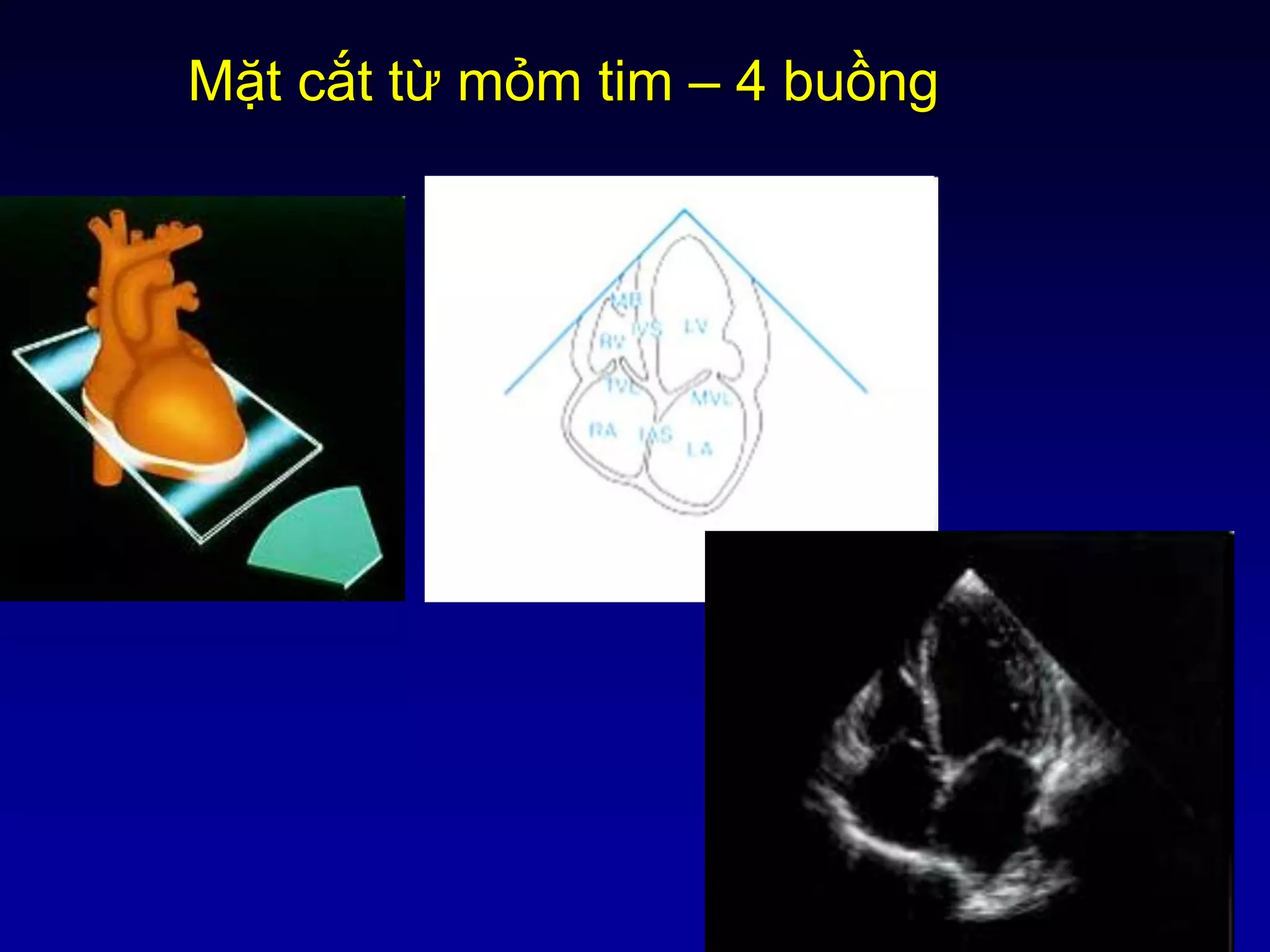 05. sieu am tim co ban | PDF