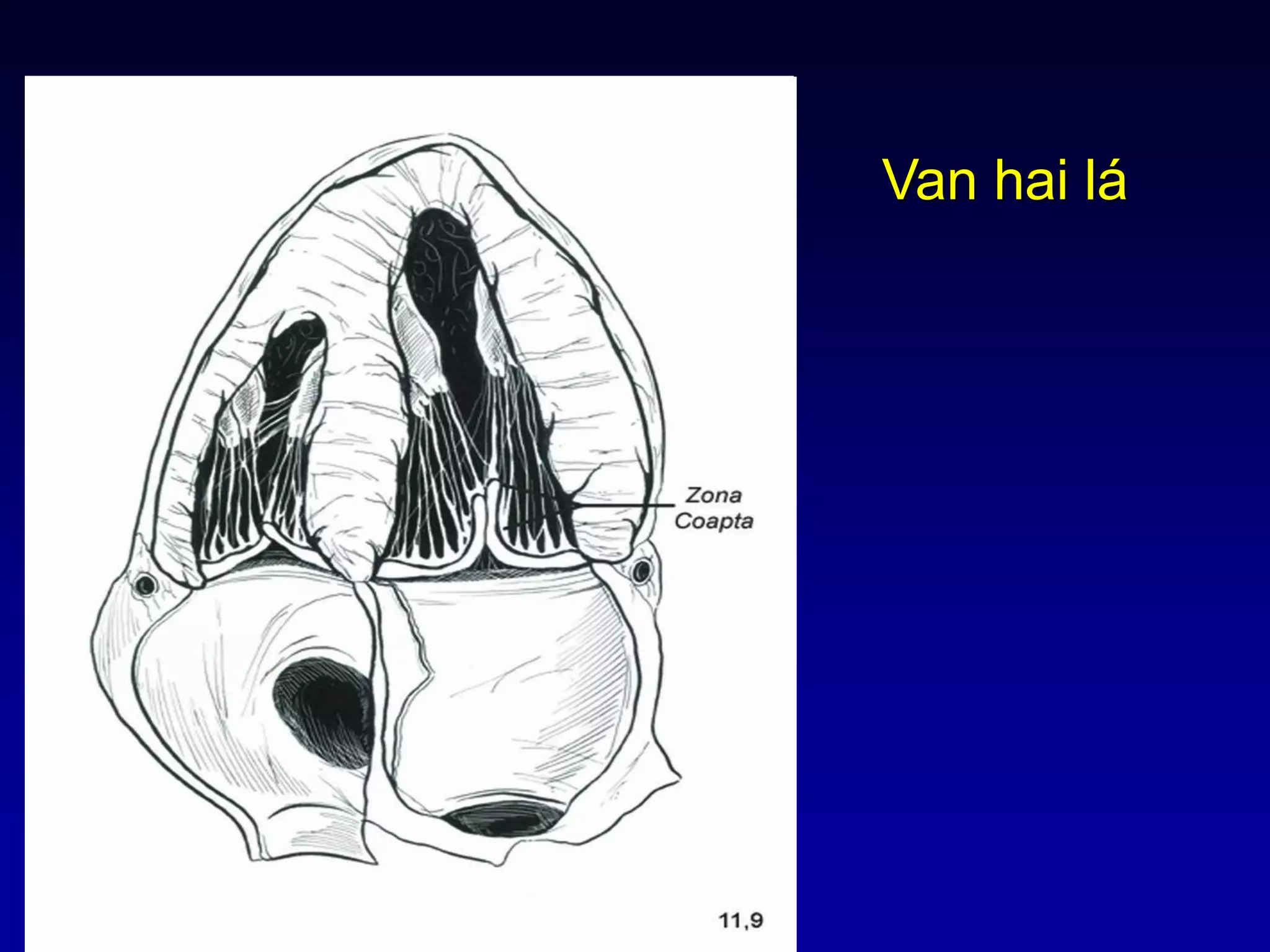 05. sieu am tim co ban | PDF